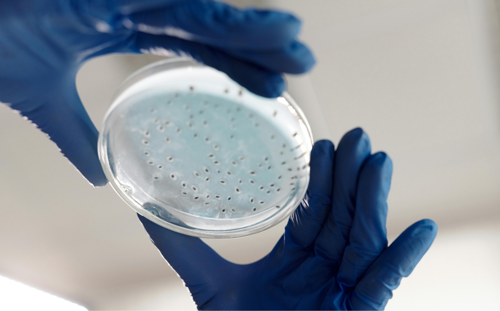 Can a Steam Cleaner Eliminate Bacteria and Viruses?